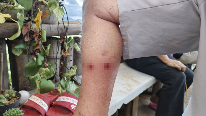 Swiss Man Bitten: Unresolved Problem of Foreigner's Dogs Plagues Thai Beach