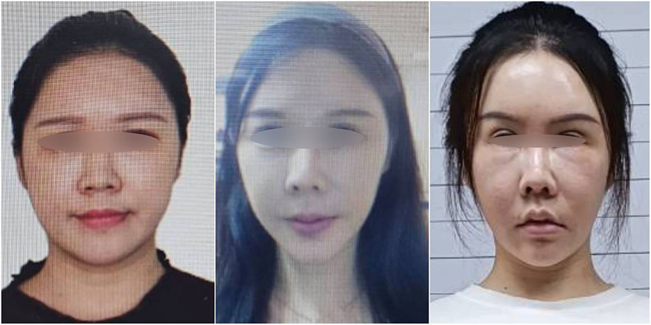 Plastic Surgery Can't Hide: Thai Immigration Nabs Chinese Fraud Suspect