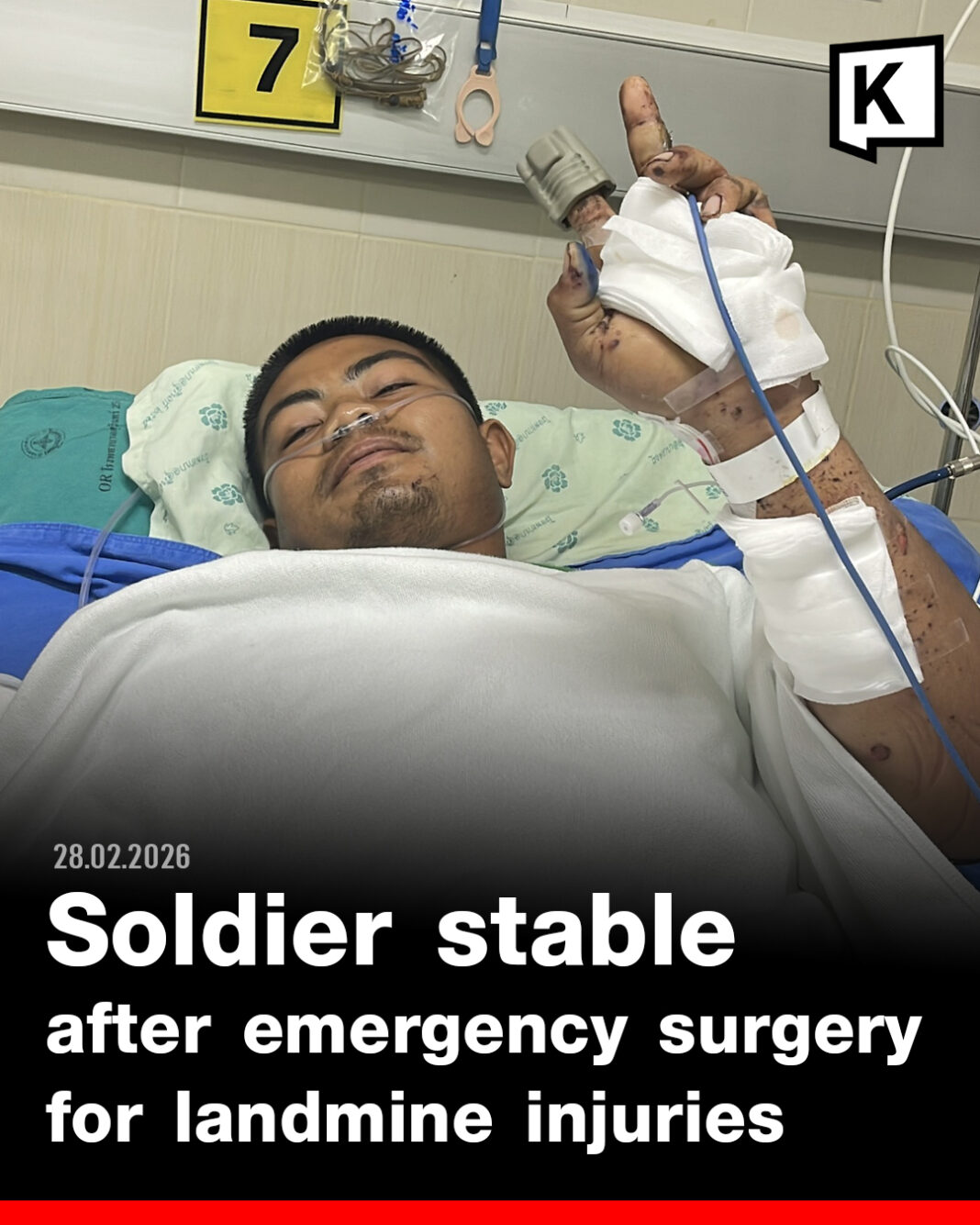 Soldier stable after emergency surgery for landmine injuries